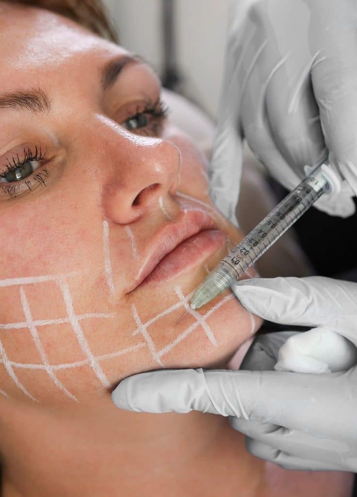 11 Benefits of Filler Injection | Skin Rejuvenation Tips by Dr. Faraji